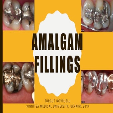 Amalgam Fillings | PPTX