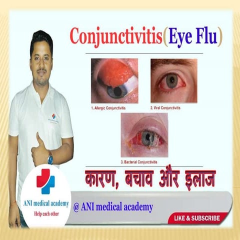 Conjunctivitis.ppt