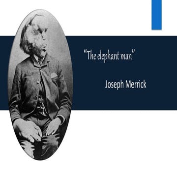 The elephant man story | PPTX