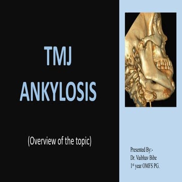 TMJ ANKYLOSIS of the Jaw and its clinical significancies | PPTX