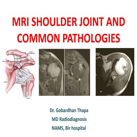 shoulder pathologies MRI: basic anatomy and MRI scans | PPTX