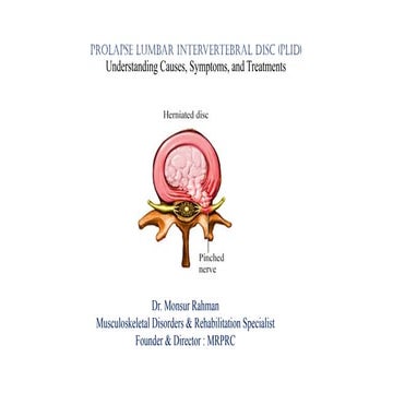 PLID: Understanding Causes, Symptoms, and Treatments | PPTX