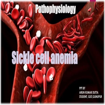 Sickle Cell Anemia Ppt By Arun Kumar Duttapptx 0814