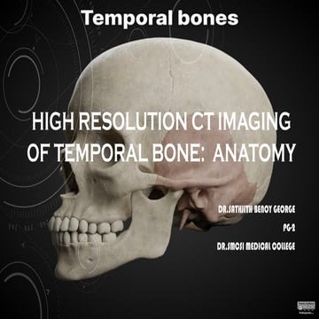 Ct temporal bone | PPTX