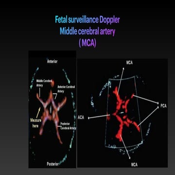 Presentation 11MCA Doppler .pdf