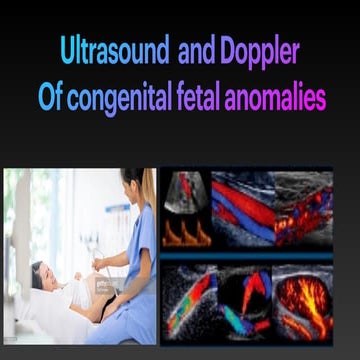 Presentation 13 doppler in fetal anomalies.pdf