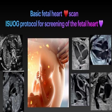 Presentation 14 fetal Echo.pdf