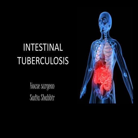 intetinal tuberculosis | PPTX