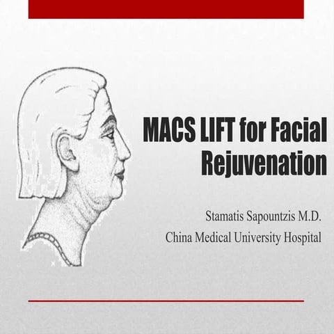 MACS Facelift | PPTX