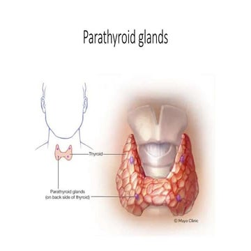 Presentation 18 of parathyroid glands surgery | PPTX