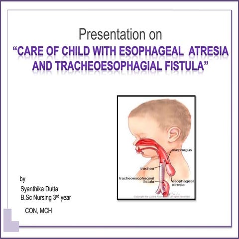 Esophageal Atresia Definition