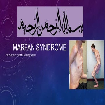 Presentation1 mfs | PPT