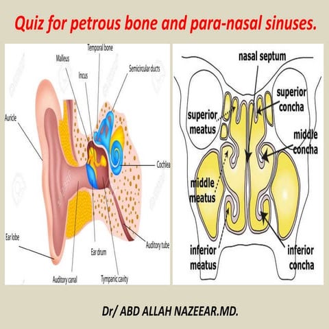 Presentation1, quiz for the petrous bone and para nasal sinuses. | PPTX