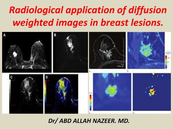PACS System in Radiology Enhancing Efficiency and Accuracy.pdf