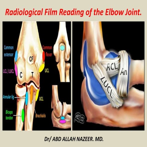 Presentation1, radiological film reading of elbow joint. | PPTX