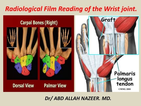 Hernias Pared Abdominal | PPT