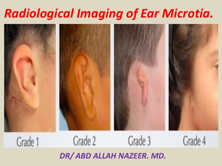 Presentation1, radiological imaging of ear microcia.
