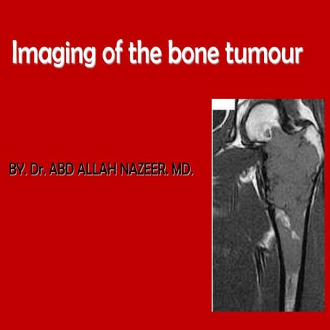 Presentation2.pptx bone tumour | PPTX