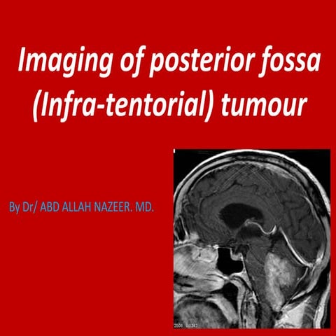 Presentation2.pptx. posterior fossa tumour | PPTX