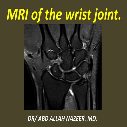 MRI WRIST SCAN PLANE AND LOCATION | PPTX