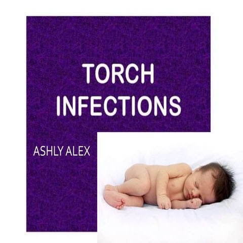 TORCH INFECTIONS | PPTX