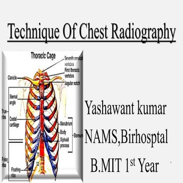 Presentation2.pptx technique chest 2 | PPTX | Death, Injury, or ...