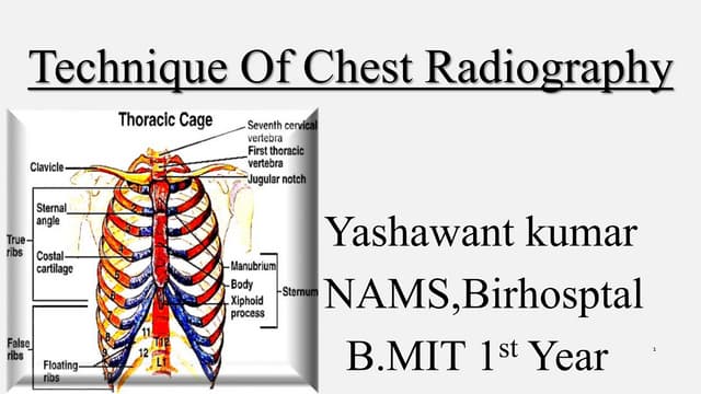 Chest radiography positioning and Technique.pptx