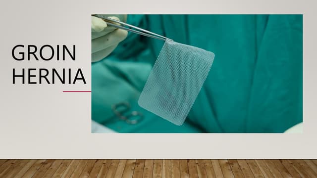 Groin Hernia Pptx