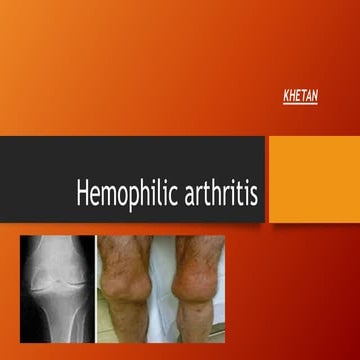 Hemophilic arthritis.pdf