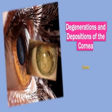 Corneal degeneration and corneal deposition | PPT