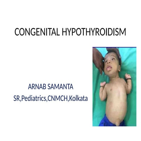 Presentation about hypothyroidism in children | PPTX