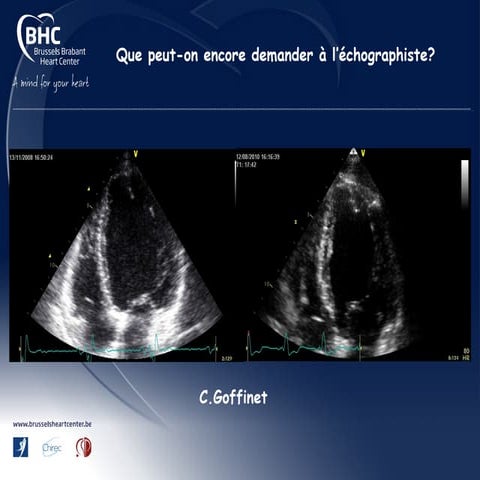 Que peut-on encore demander à l'échocardiographiste? (Dr C. Goffinet) | PPT