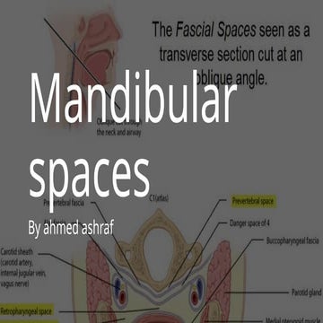 Mandibular space infections Presentation3.pptx