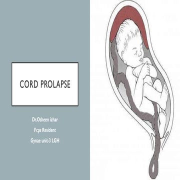 Cord prolapse & cord presentation | PPTX