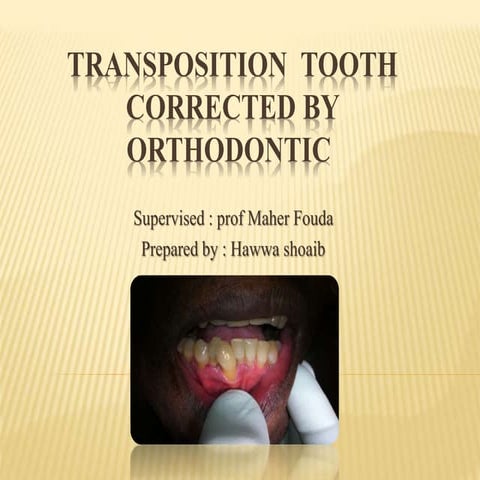 Transposition tooth corrected by orthodontic | PPTX