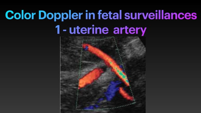 Doppler In Fetal Surveillance Uterine Artery Assessment Ppt