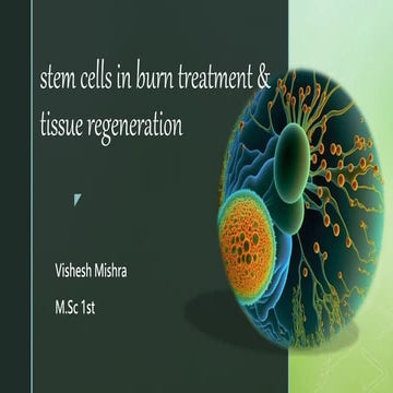 Stem cell in burn treatment | PPTX