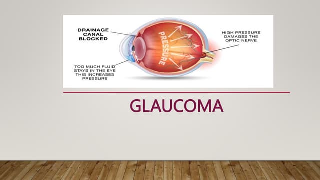Glaucoma (opthalmology) | PPTX