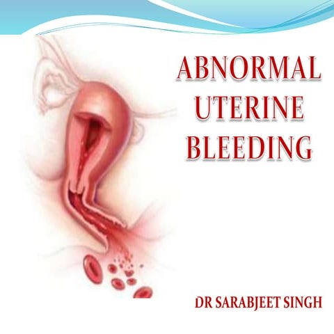PALM-COEIN Classification of AUB (Abnormal Uterine Bleeding) | PDF