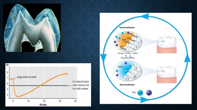 SILVER DIAMINE FLUORIDE (SDF) | PPTX