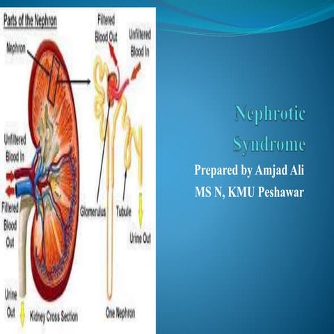 Presentation on nephrotic syndrome | PPTX
