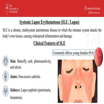 PRESENTATION Systemic Lupus Erythem.pptx