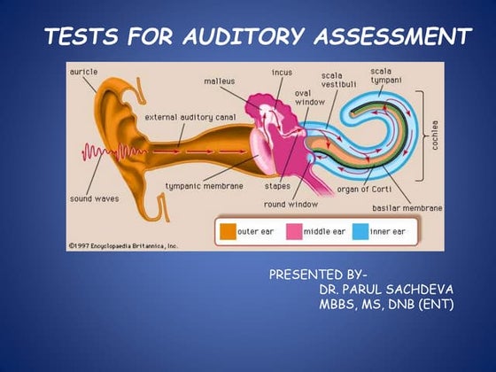 Auditory brainstem response (ABR) | PPTX | Digital Audio | Computer ...