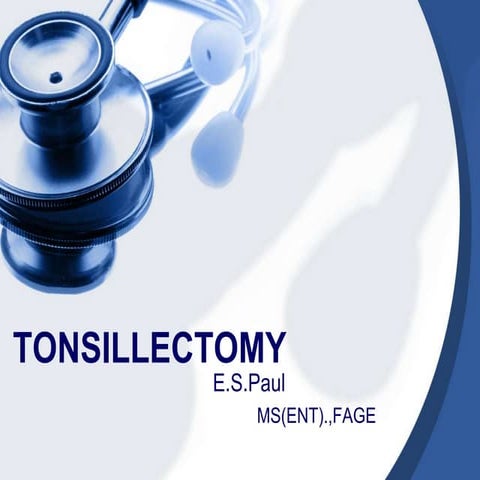 Tonsillectomy | PPTX