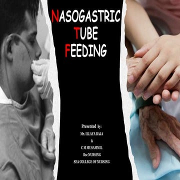 NASOGASTRIC TUBE FEEDING or NG tube feeding | PPTX