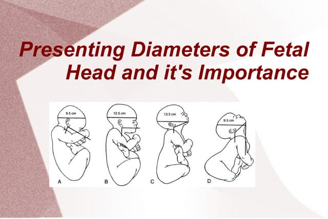 Fetopelvic relationship | PPTX