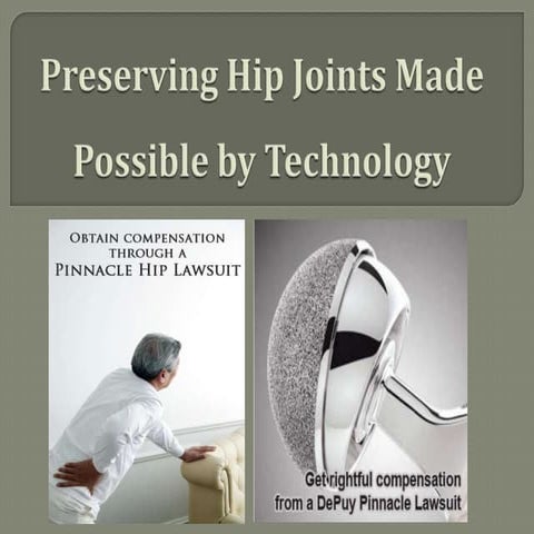 Preserving Hip Joints Made Possible by Technology | PPTX