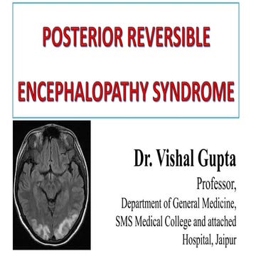 POSTERIOR REVERSIBLE ENCEPHALOPATHY SYNDROME | PPTX