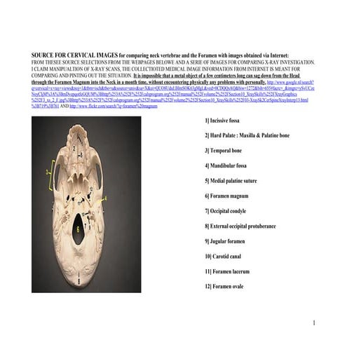 FORAMEN MAGNUM AND ITS SURROUNDING STRUCTURES.pptx