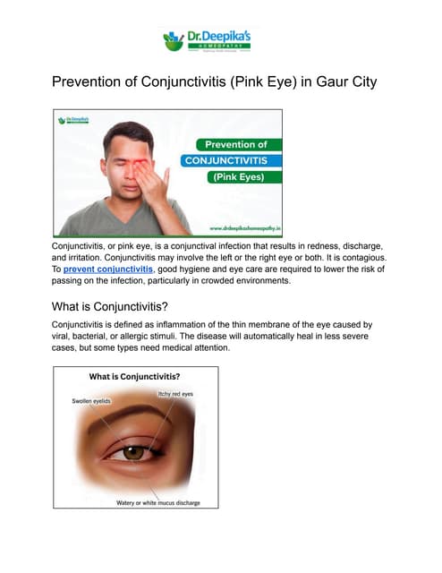 Conjuctivitis.pptx